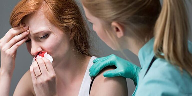 Nosebleeds and what to do in the case of one - Doctor Urgent Medical Care